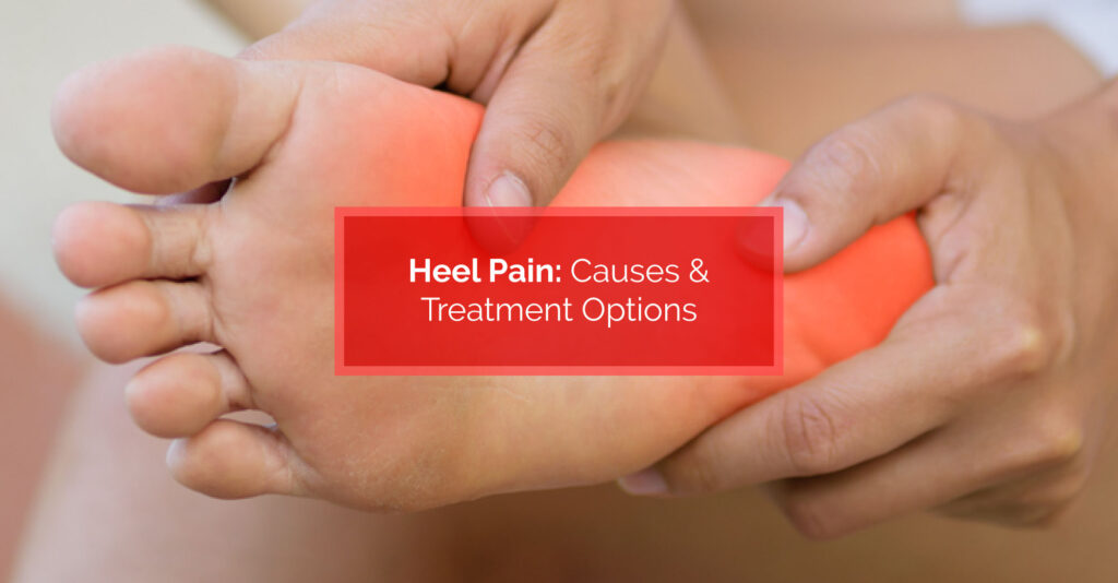 Heel Pain: Causes & Treatment Options | Physiomed