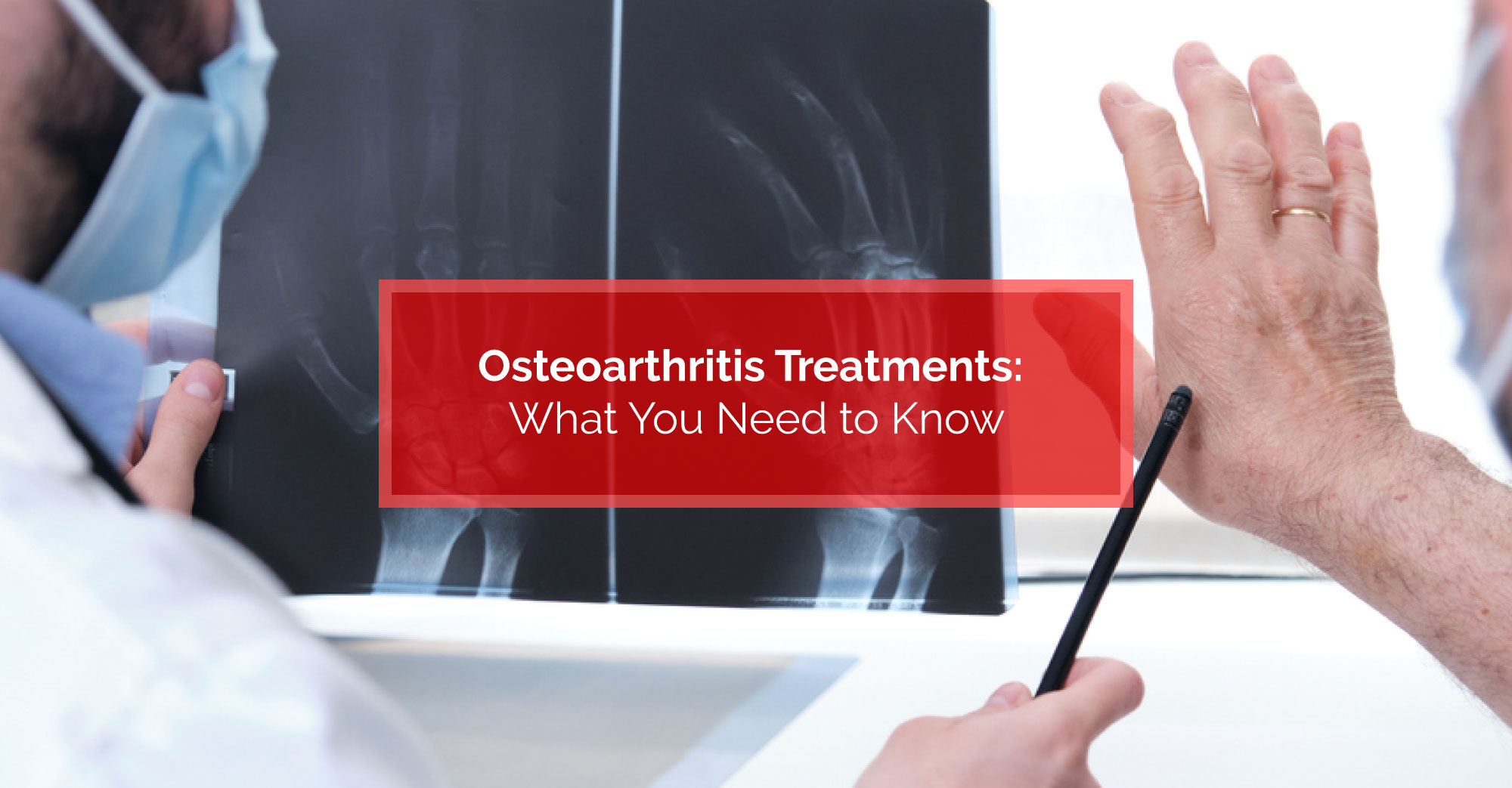Osteoarthritis Treatments: What You Need to Know | Physiomed